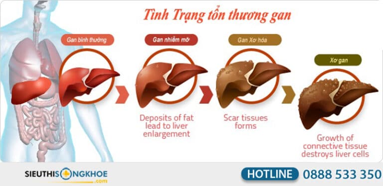 Boganic Forte [115.000đ] - Hỗ Trợ Phục Hồi & Thanh Lọc Gan
